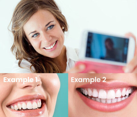 Smile Assessment | Oakleigh Smiles